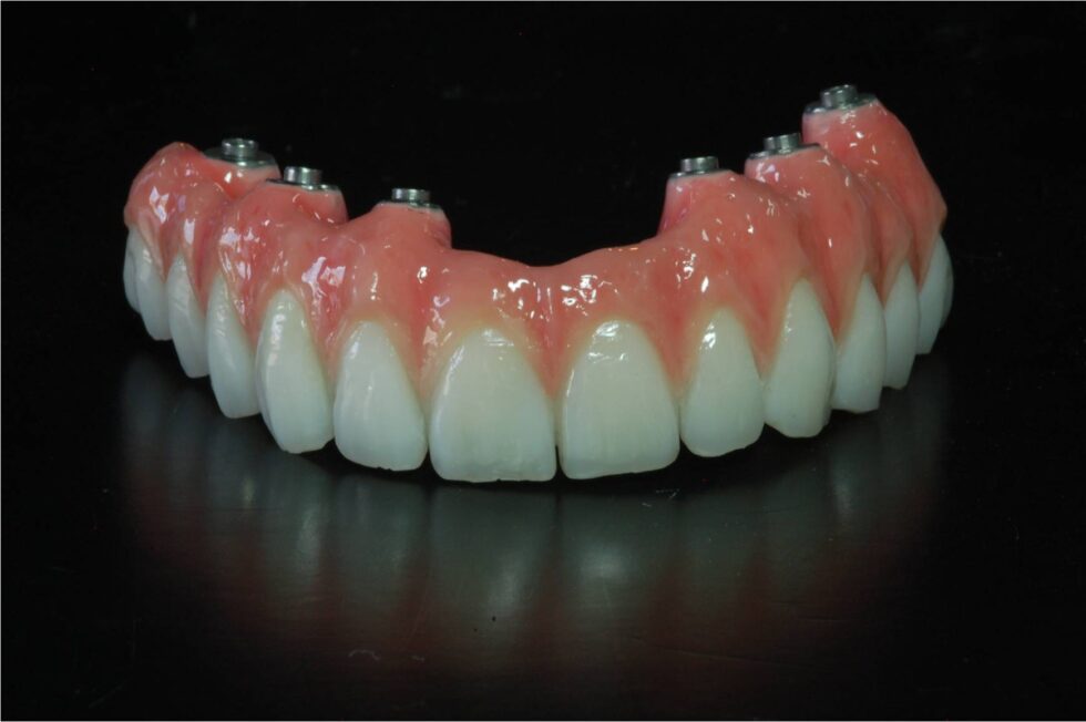 Valplast - JF.dental