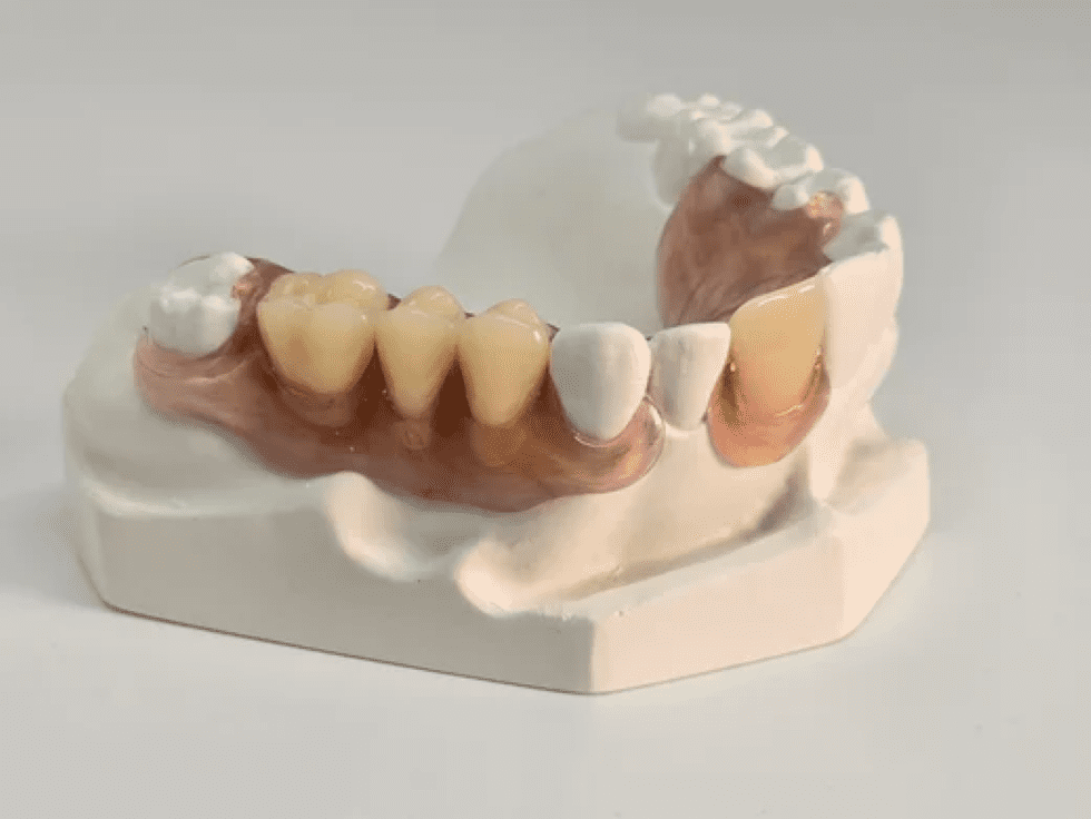 Valplast - JF.dental